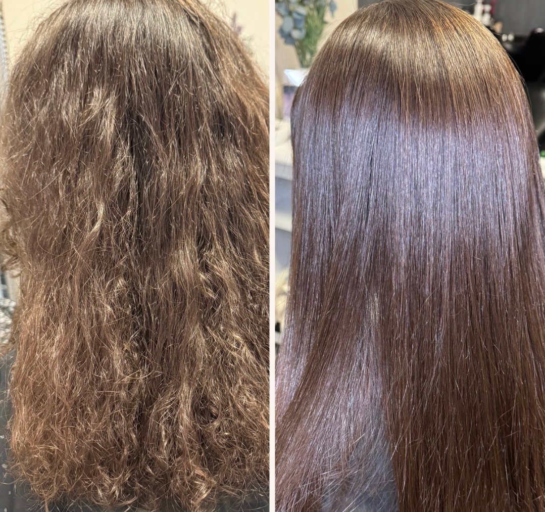 Nanoplastia - KEP beauty